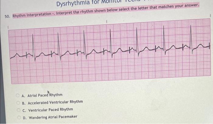 Solved sn Rhvthm Interpretation -. Interpret the rhythm | Chegg.com
