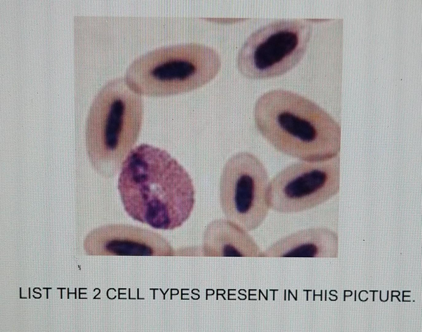 Solved LIST THE 2 CELL TYPES PRESENT IN THIS PICTURE. | Chegg.com