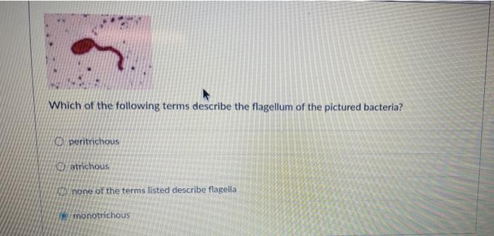 Solved Which of the following terms describe the flagellum | Chegg.com