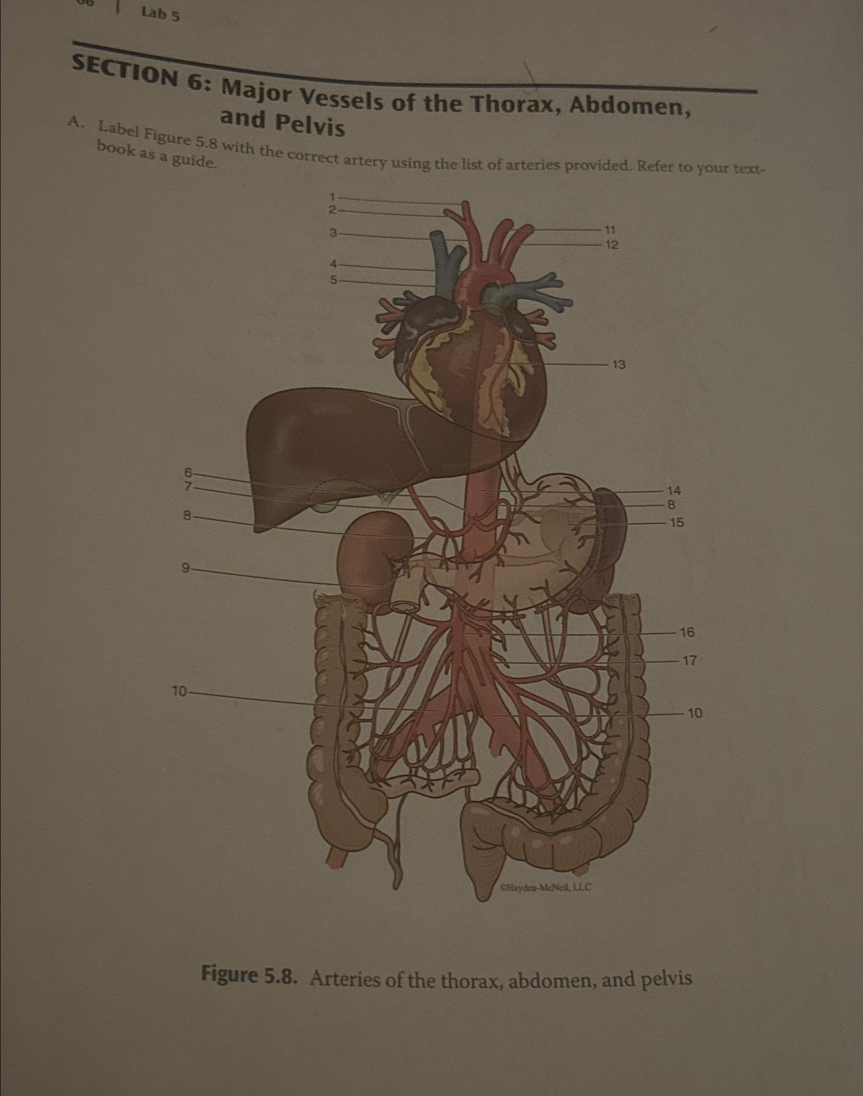 Solved Lab 5SECTION 6: Major Vessels of the Thorax, Abdomen, | Chegg.com