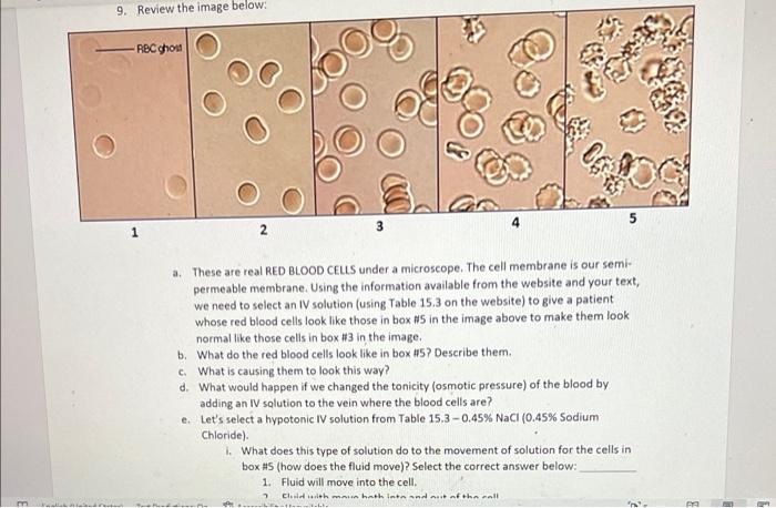 Solved a. These are real RED BLOOD CELLS under a microscope. | Chegg.com