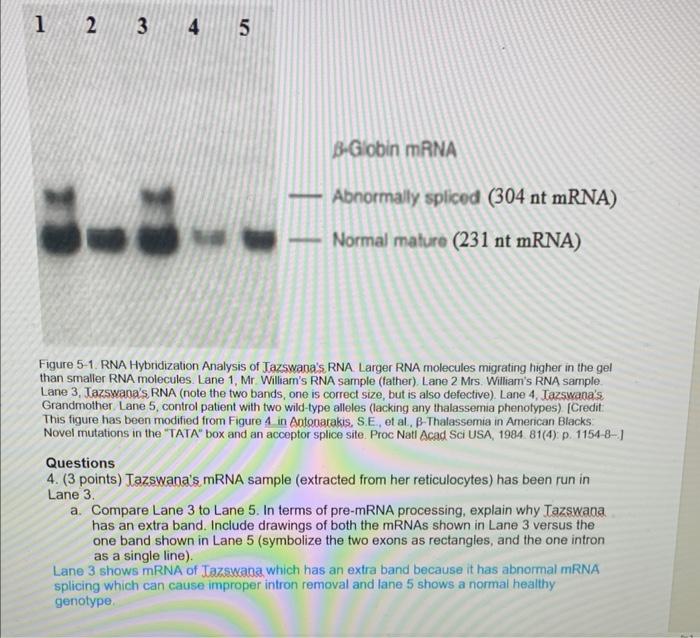 Solved Figure 5-1. RNA Hybridization Analysis of Jazswana's | Chegg.com