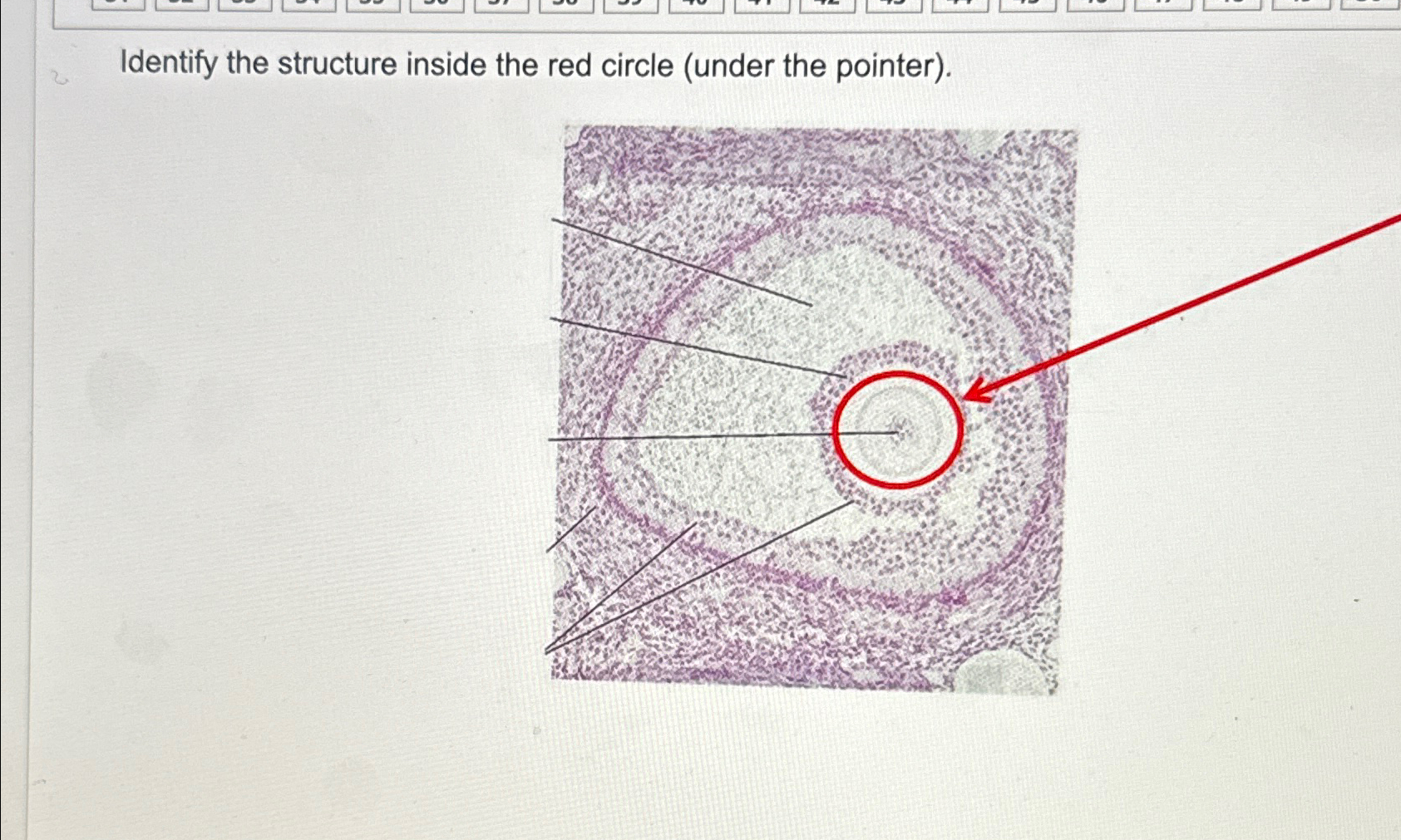 Solved Identify the structure inside the red circle (under | Chegg.com