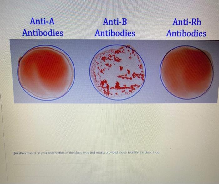 Solved Anti-A Antibodies Anti-B Antibodies Anti-Rh | Chegg.com