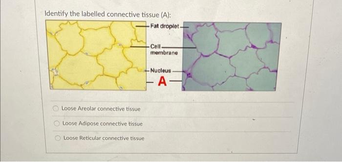 Solved Identify the labelled epithelium (A): Simple cuboidal | Chegg.com