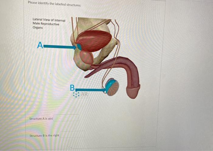 Solved Please identify the labelled structures: Lateral View | Chegg.com