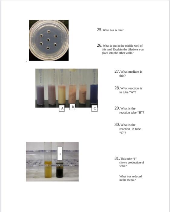 Microbiology Lab Uninoculated a Practical II REVIEW | Chegg.com