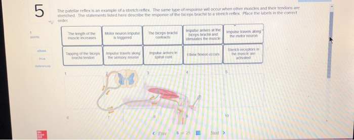 Solved The patellar reflex is an example of a stretch | Chegg.com