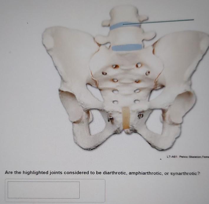 Solved 6 0 C LT-AS1 Skeleton Are the highlighted joints | Chegg.com