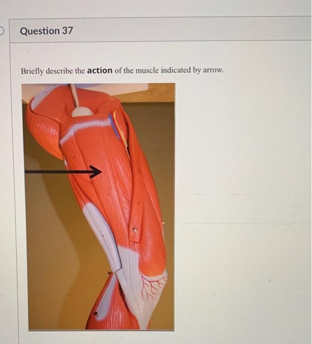 Solved Identify the muscle indicated by yellow | Chegg.com