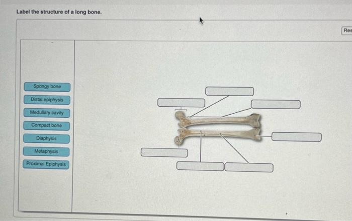 Solved Label the structure of a long bone. | Chegg.com