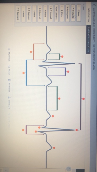 Solved CARDIOVASCULAR PHYSIOLOGY - ELECTROCARDIOGRAPHY | Chegg.com