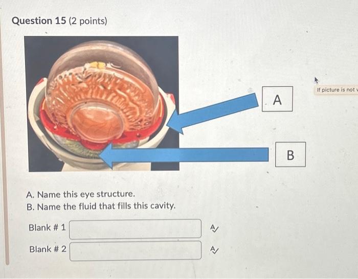 Solved Question 15 (2 points) A. Name this eye structure. B. | Chegg.com