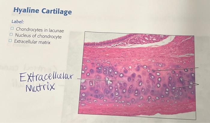 Solved Hyaline Cartilage Label: Chondrocytes in lacunae | Chegg.com