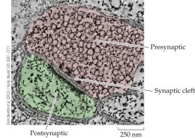 Solved Refer to the figure. ﻿The figure shows an electron | Chegg.com