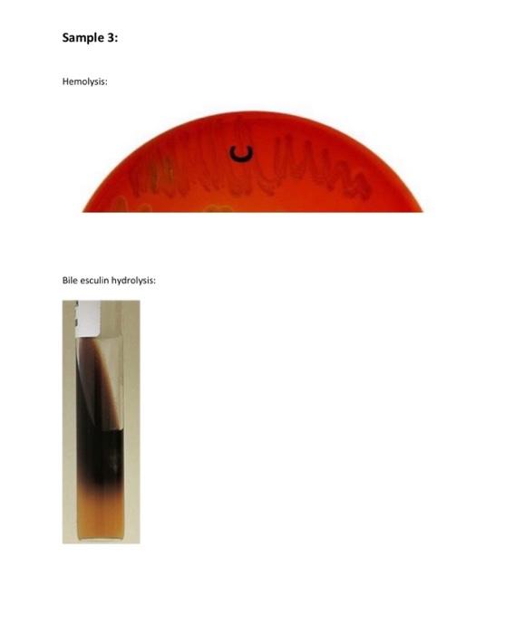 Solved The following are the results after incubation of | Chegg.com