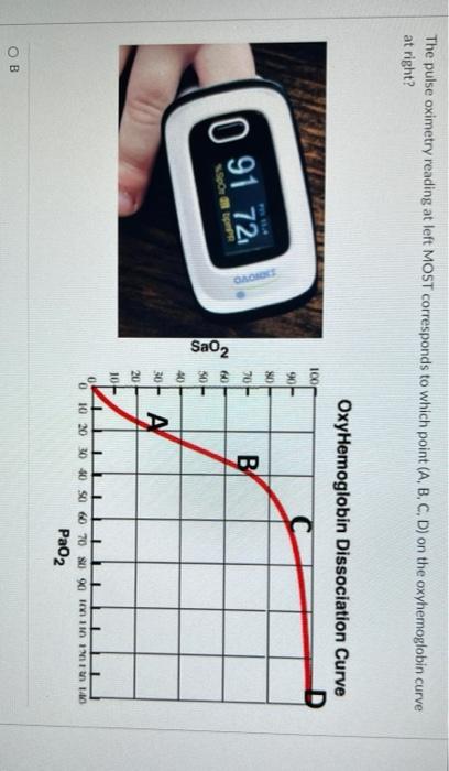 Solved The pulse oximetry reading at left MOST corresponds | Chegg.com