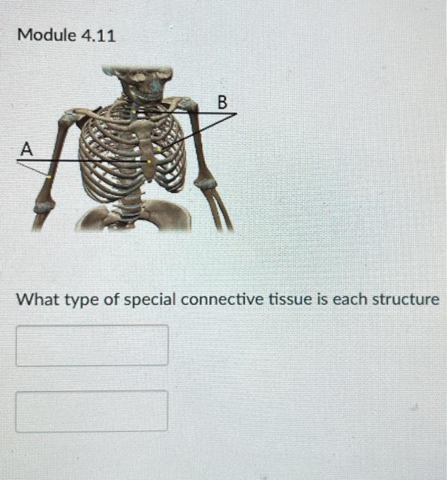 Solved Module 4.11 What type of special connective tissue is | Chegg.com