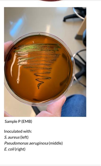 EXERCISE 14: BLOOD AGAR PLATE(BAP) Complete the table | Chegg.com
