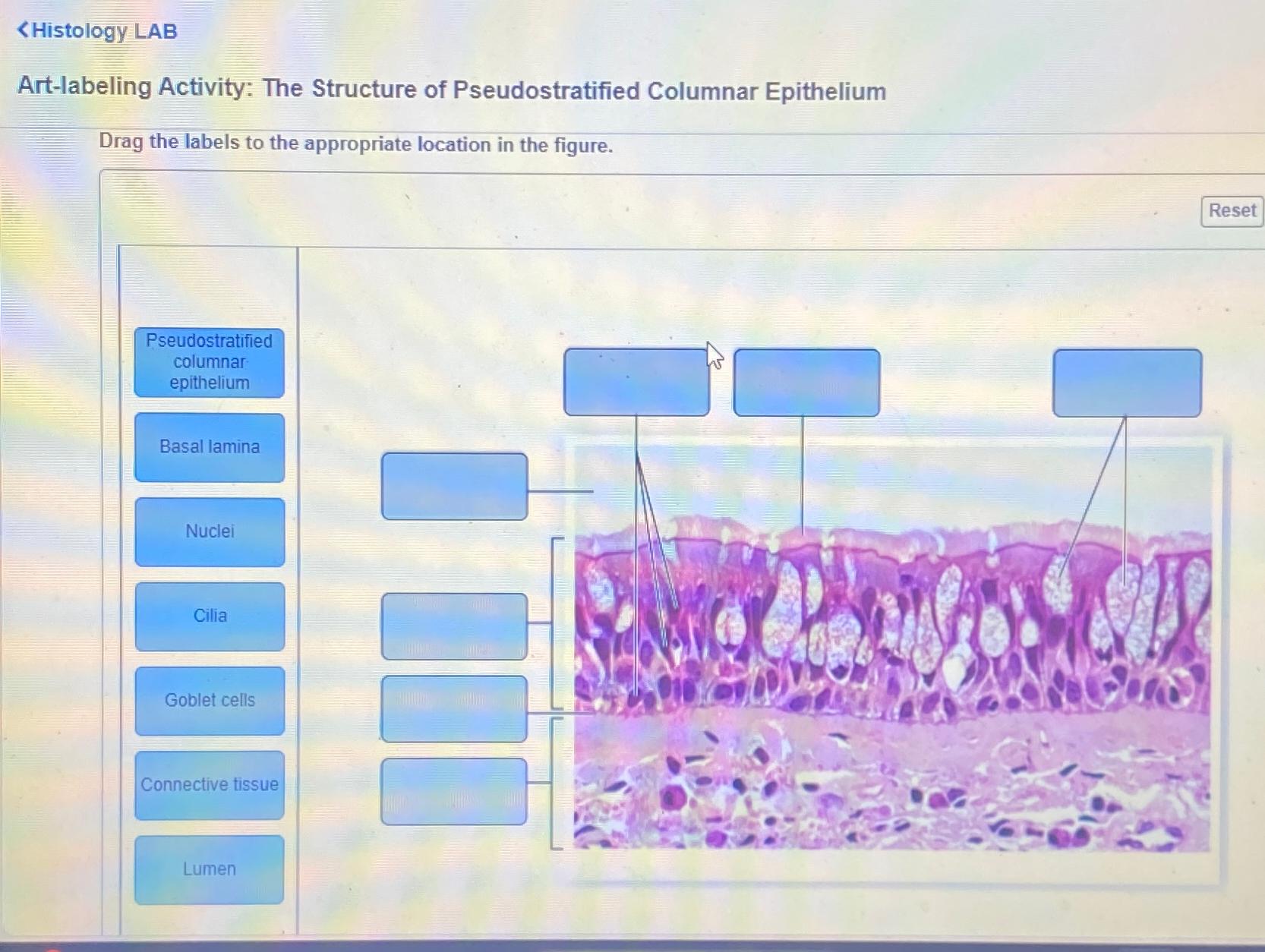 Solved Basil, Lena, nuclei, Celia, goblet cells, lumen | Chegg.com