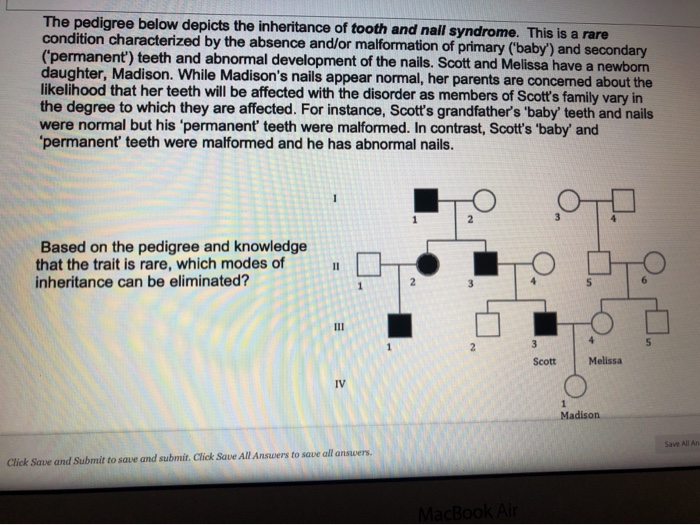 Solved The pedigree below depicts the inheritance of tooth | Chegg.com