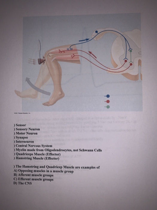 Solved 12. Pyrogens cause fever and are released by A) Brain | Chegg.com