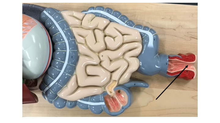 Solved Identify the organ marked by the black arrow. Note: | Chegg.com