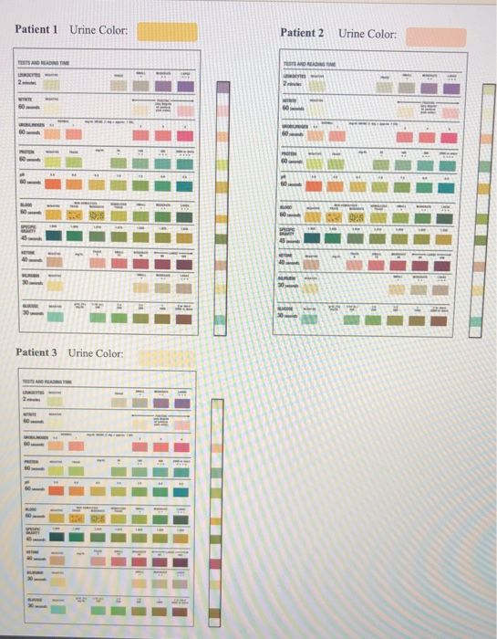 Solved A complete urinalysis involves an examination of the | Chegg.com
