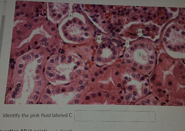 Solved Identify the pink fluid labeled Identify the pink | Chegg.com