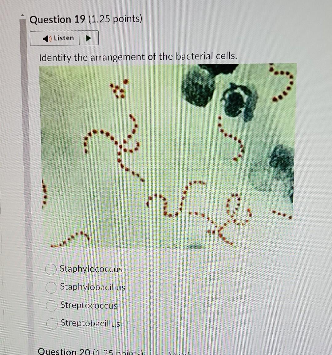 Solved Did not primary stain long enough Under-Decolorized | Chegg.com
