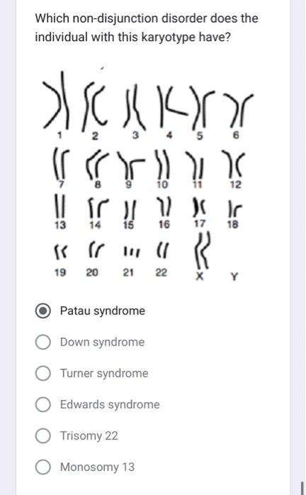Solved Which non-disjunction disorder does the individual | Chegg.com