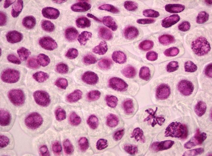 Solved count the number of cells in each of the cell phases, | Chegg.com