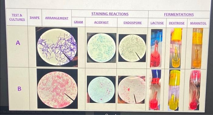 Solved STAINING REACTIONS TEST & CULTURES SHAPE ARRANGEMENT | Chegg.com