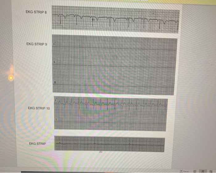 Solved please use the ekg diagram to answer the matching | Chegg.com
