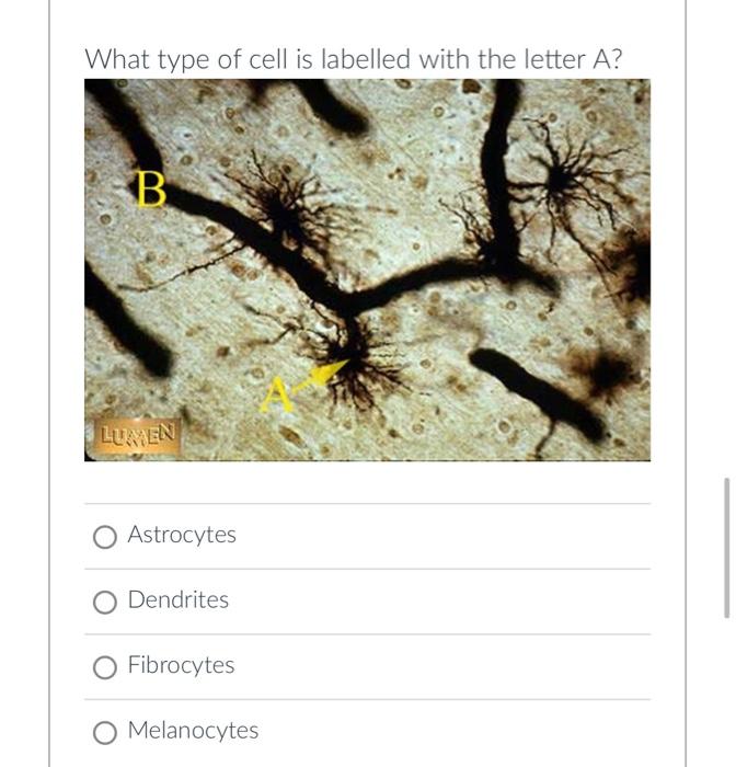 Solved Identify the structure highlighted in blue? Neuron | Chegg.com