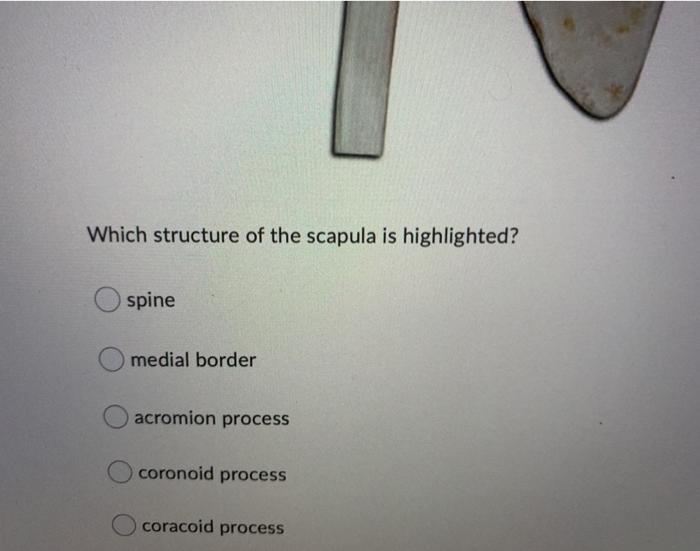 Solved Which structure of the scapula is highlighted? spine | Chegg.com