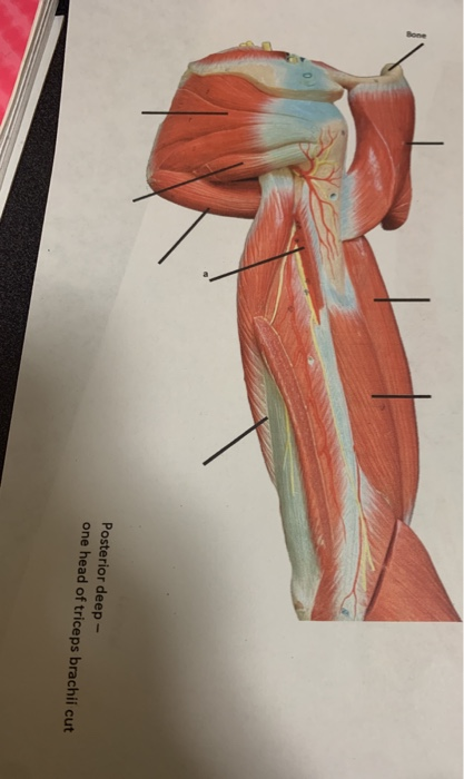 Solved Posterior deep - one head of triceps brachii cut | Chegg.com