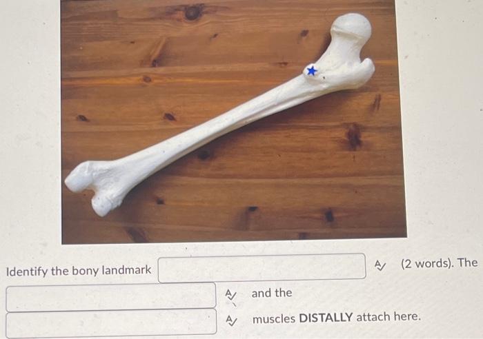 Solved 1. Identify the bony landmark of the knee, and the 2 | Chegg.com