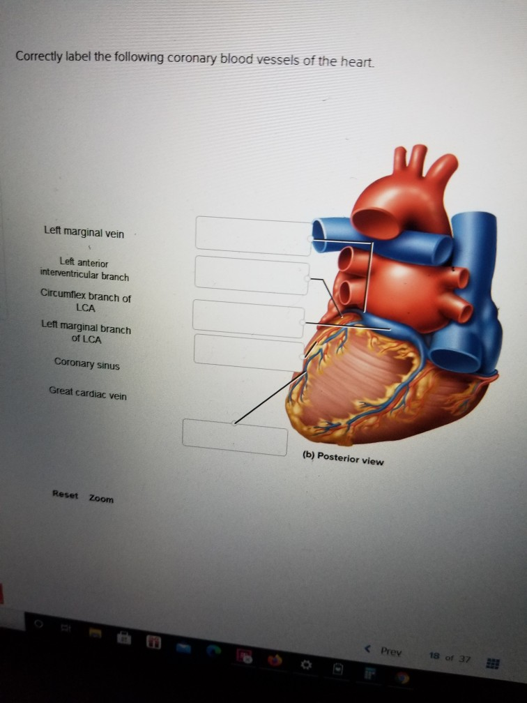 Solved Correctly label the following coronary blood vessels | Chegg.com
