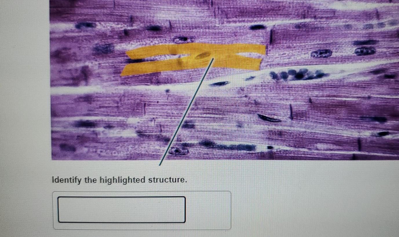 Solved Identify the highlighted structure. | Chegg.com