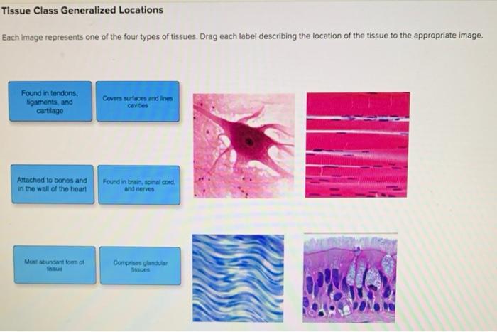 Solved Tissue Class Generalized Locations Each image | Chegg.com
