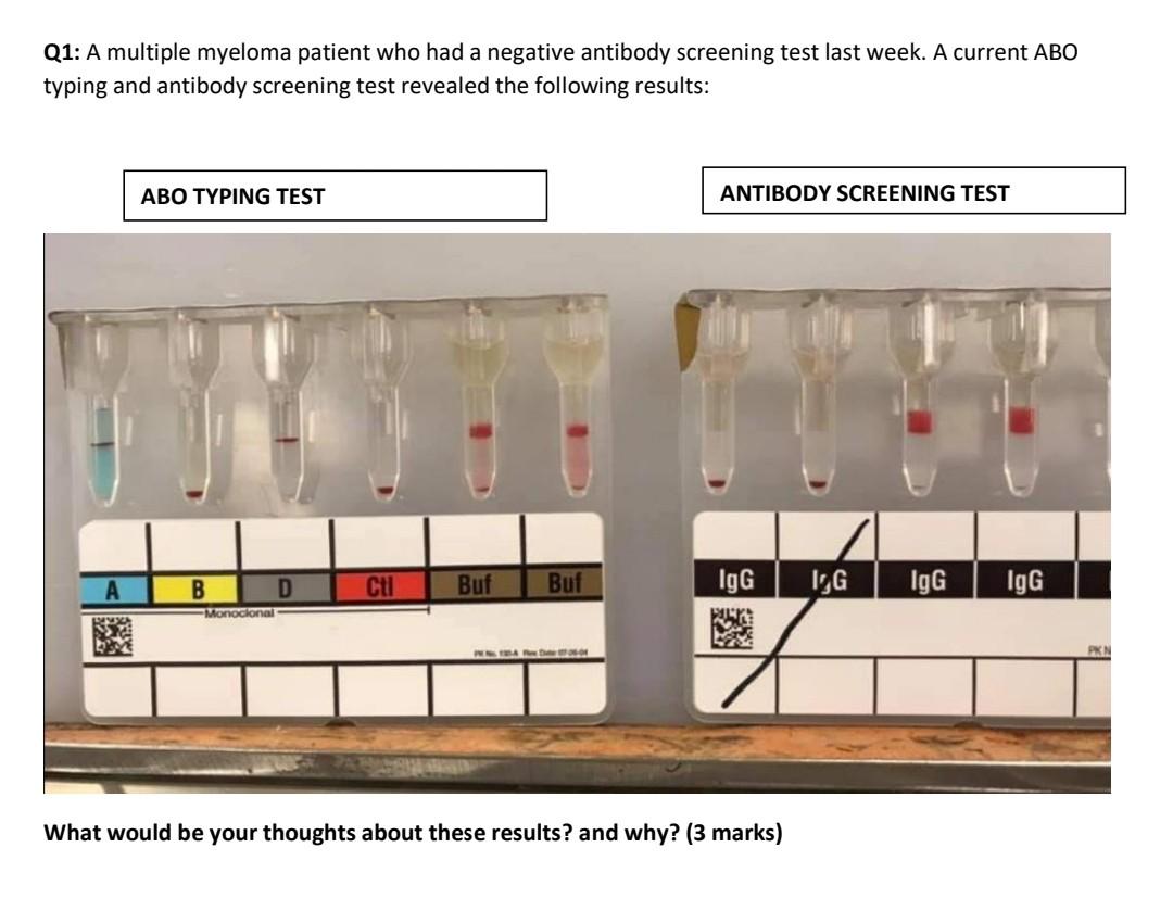 Solved Q3: a 33 years old male patient with O positive blood | Chegg.com