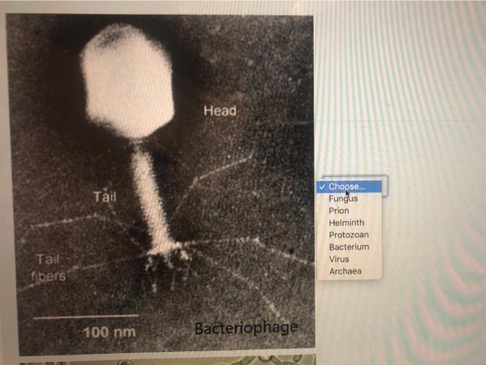 Solved Head Tail Chopse... Fungus Prion Helminth Protozoan | Chegg.com