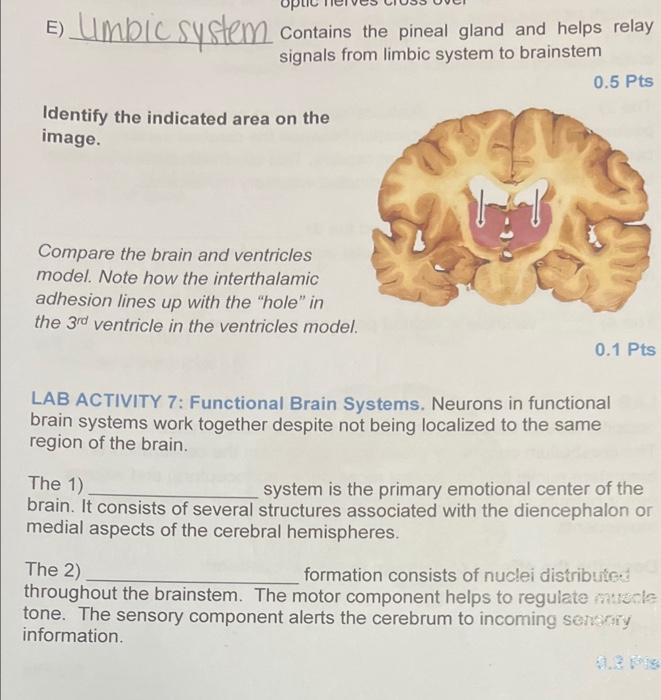 Solved E) Umbic system contains the pineal gland and helps | Chegg.com