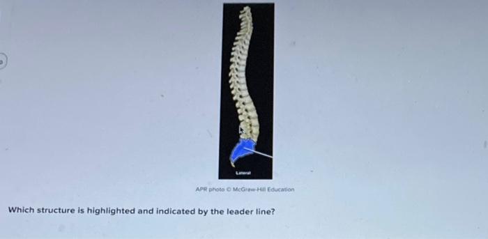 Solved APR photo © McGraw-Hill Education Which structure is | Chegg.com