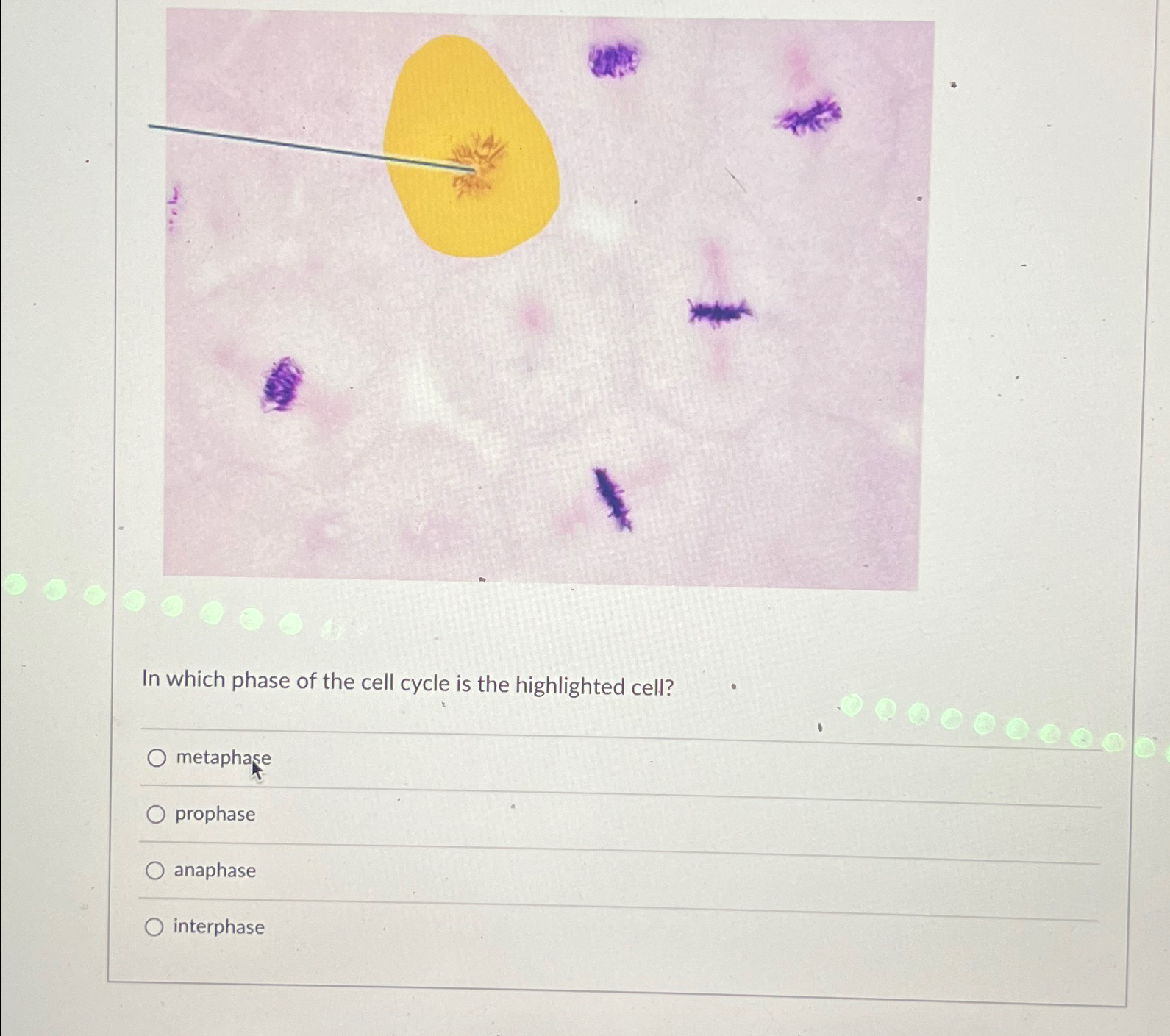 Solved In which phase of the cell cycle is the highlighted | Chegg.com