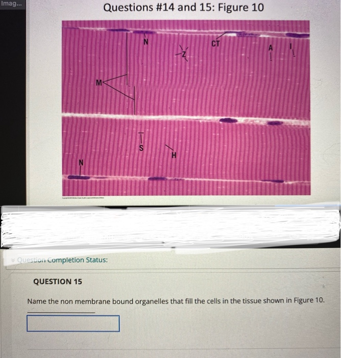 Solved Imag... Questions #14 and 15: Figure 10 MS Question | Chegg.com