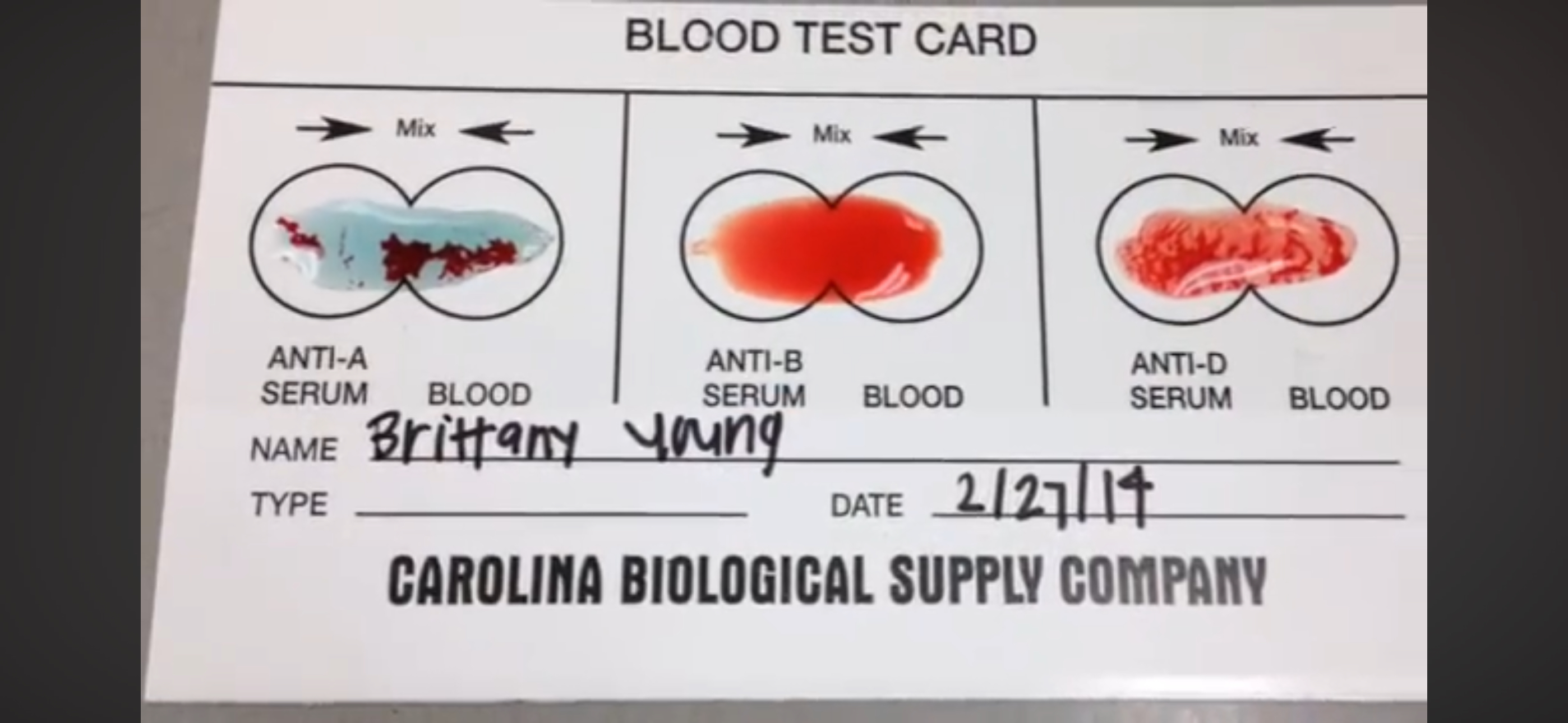 Solved BLOOD TEST CARD, whats the blood type according to | Chegg.com