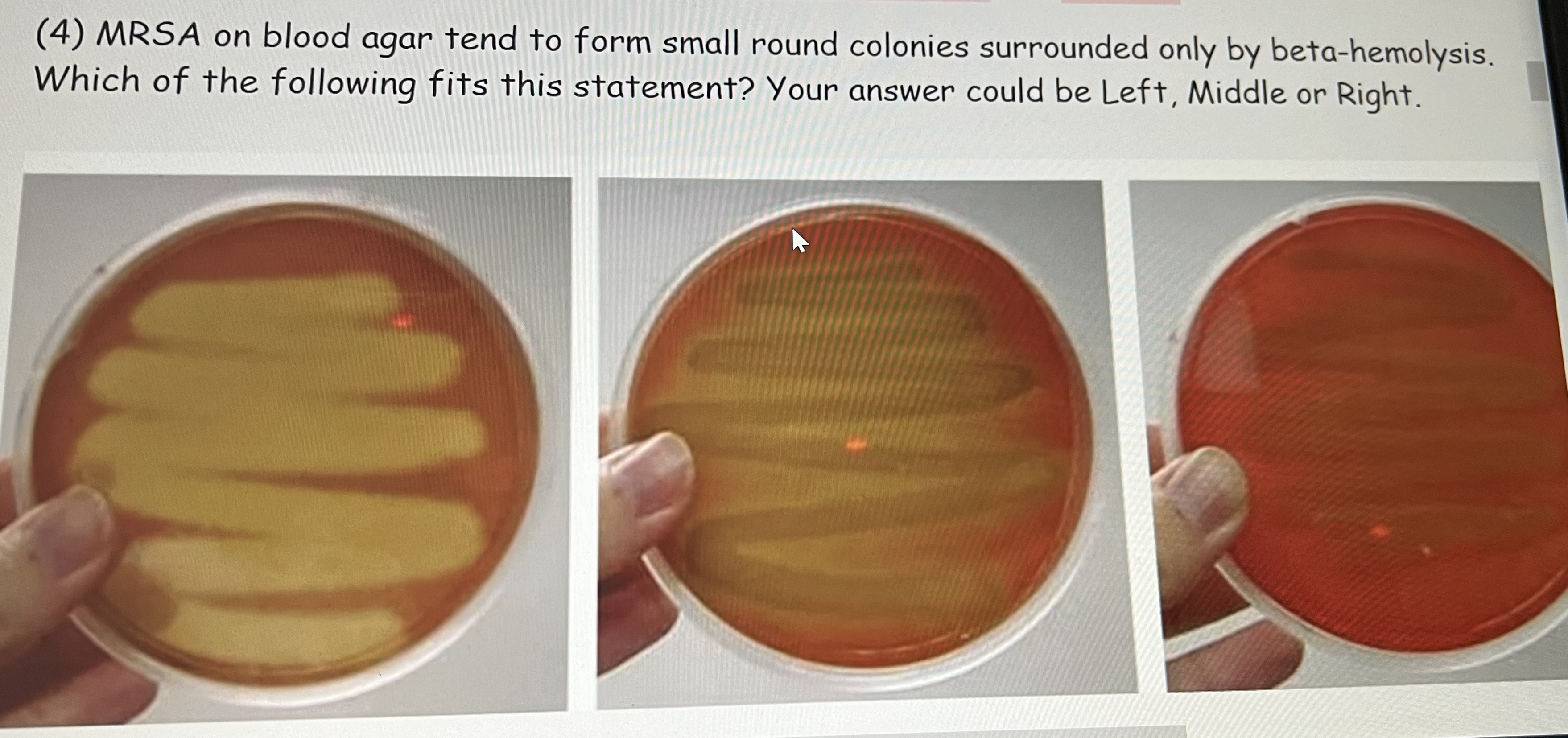 Solved (4) ﻿MRSA on blood agar tend to form small round | Chegg.com