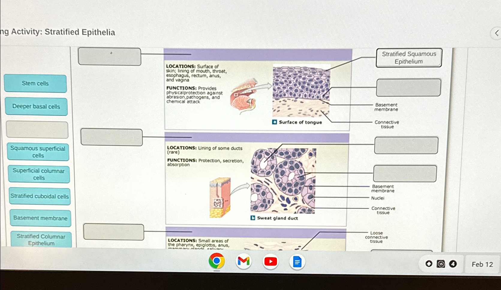 Solved ng Activity: Stratified Epithelia | Chegg.com